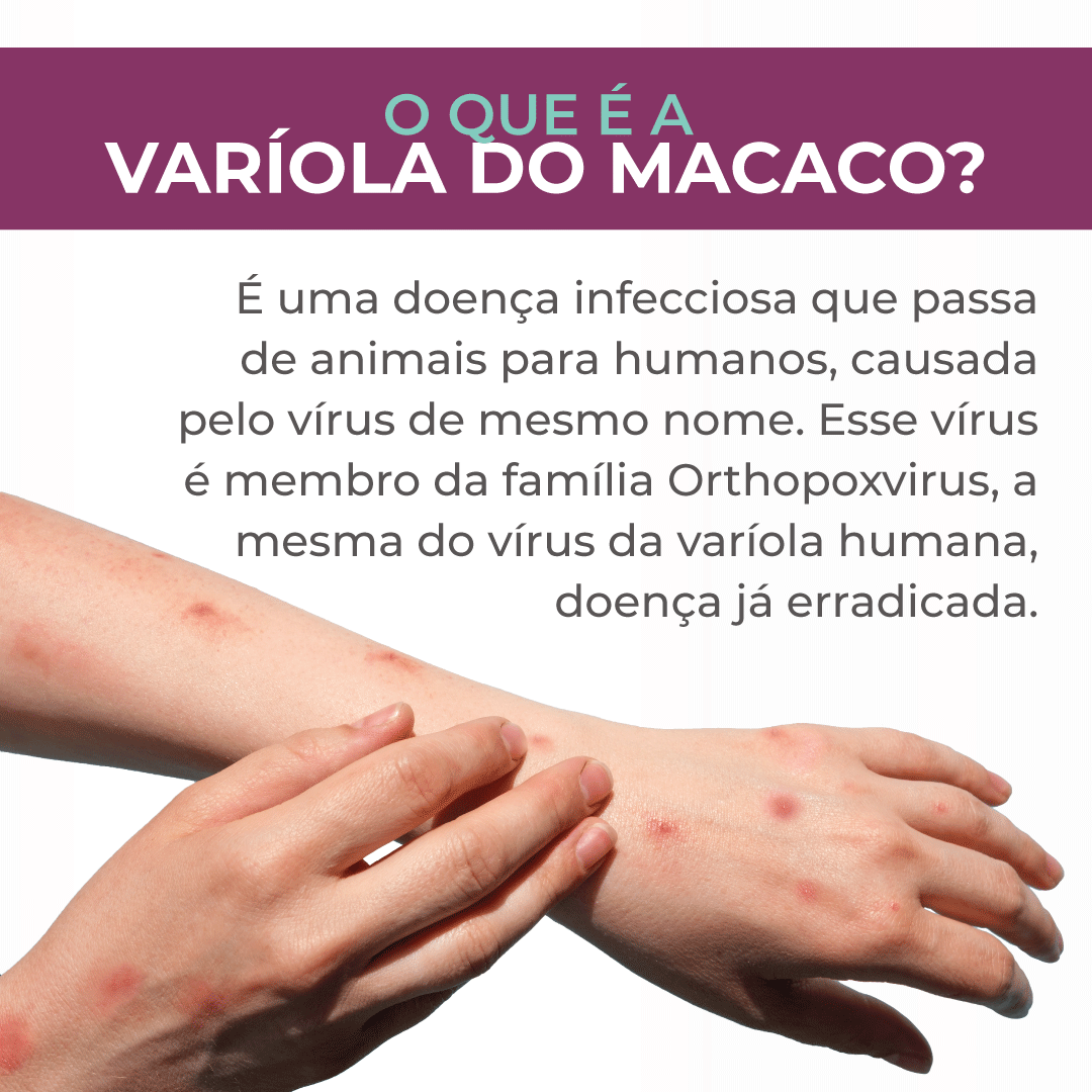 O que é a Varíola do Macaco? - Instituto Cisne Barueri